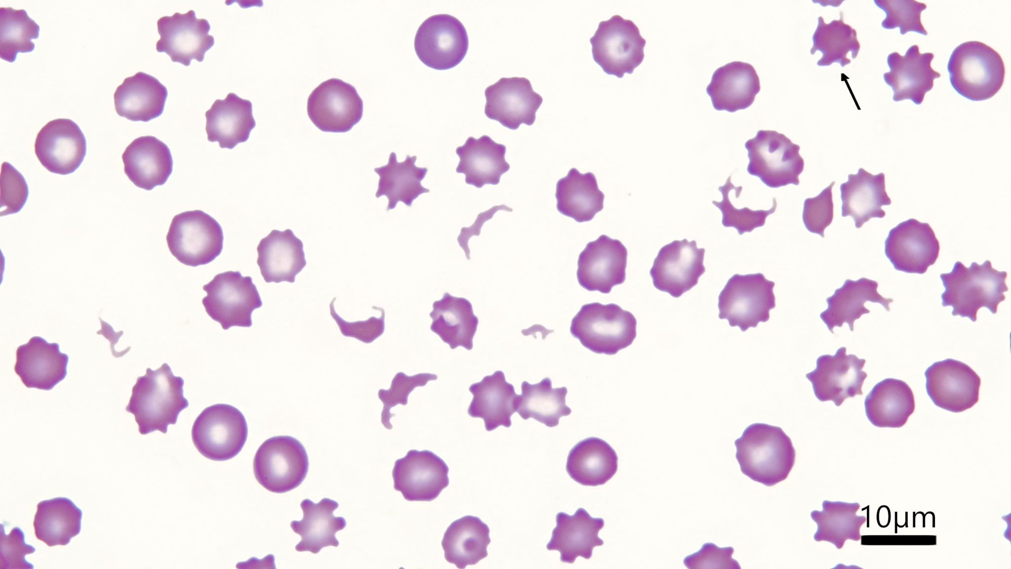 顕微鏡写真: 犬の有棘赤血球とウニ状赤血球 - せがわ動物病院